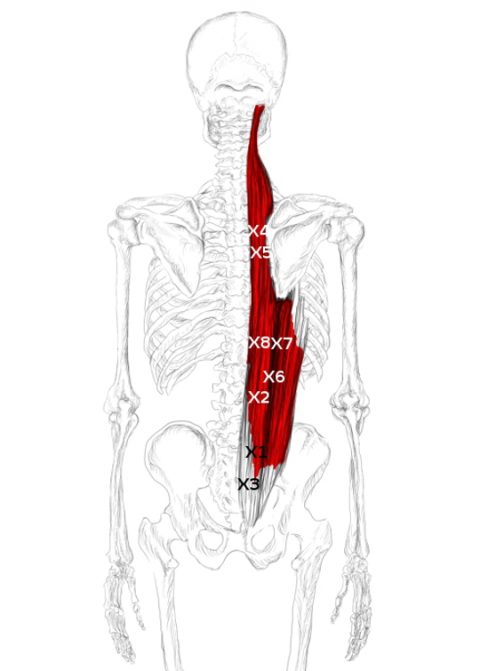 Muscle érecteur du rachis : douleurs et trigger points