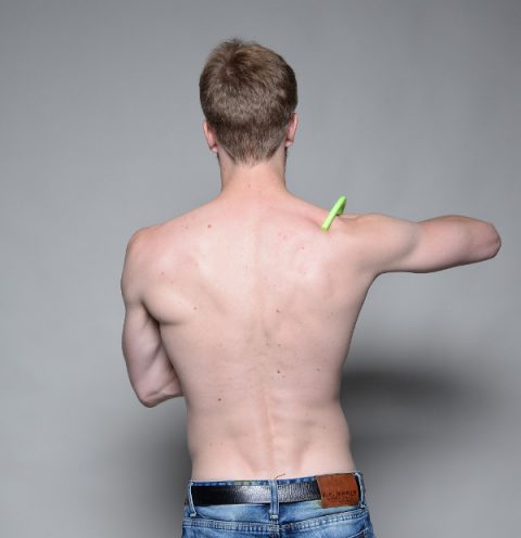 Muscle supra-épineux : douleurs et trigger points
