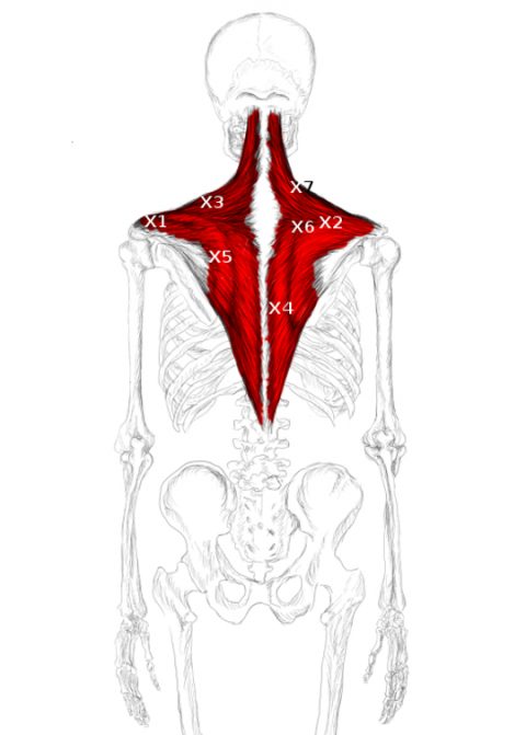 Muscle trapèze : douleurs et trigger points